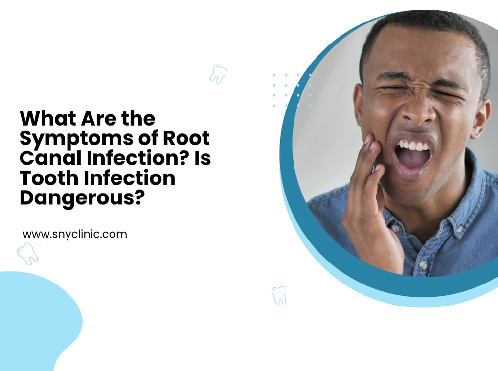 What Are the Symptoms of Root Canal Infection? Is Tooth Infection ...
